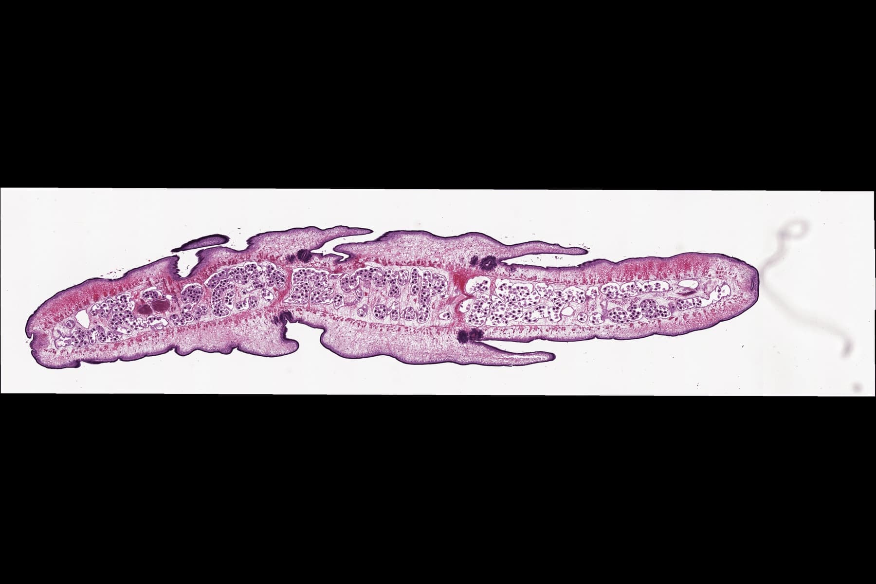 Tapeworm Whole Slide Image Viewer-uScopeHXII 20x (0.65NA ...