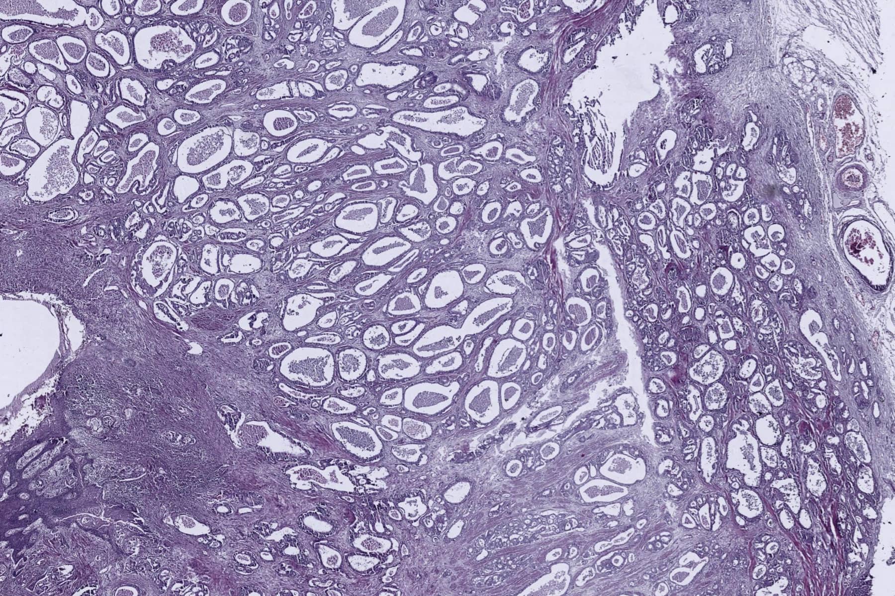 Breast Cancer Whole Slide Image Viewer-uScopeHXII 40x (0.80NA ...