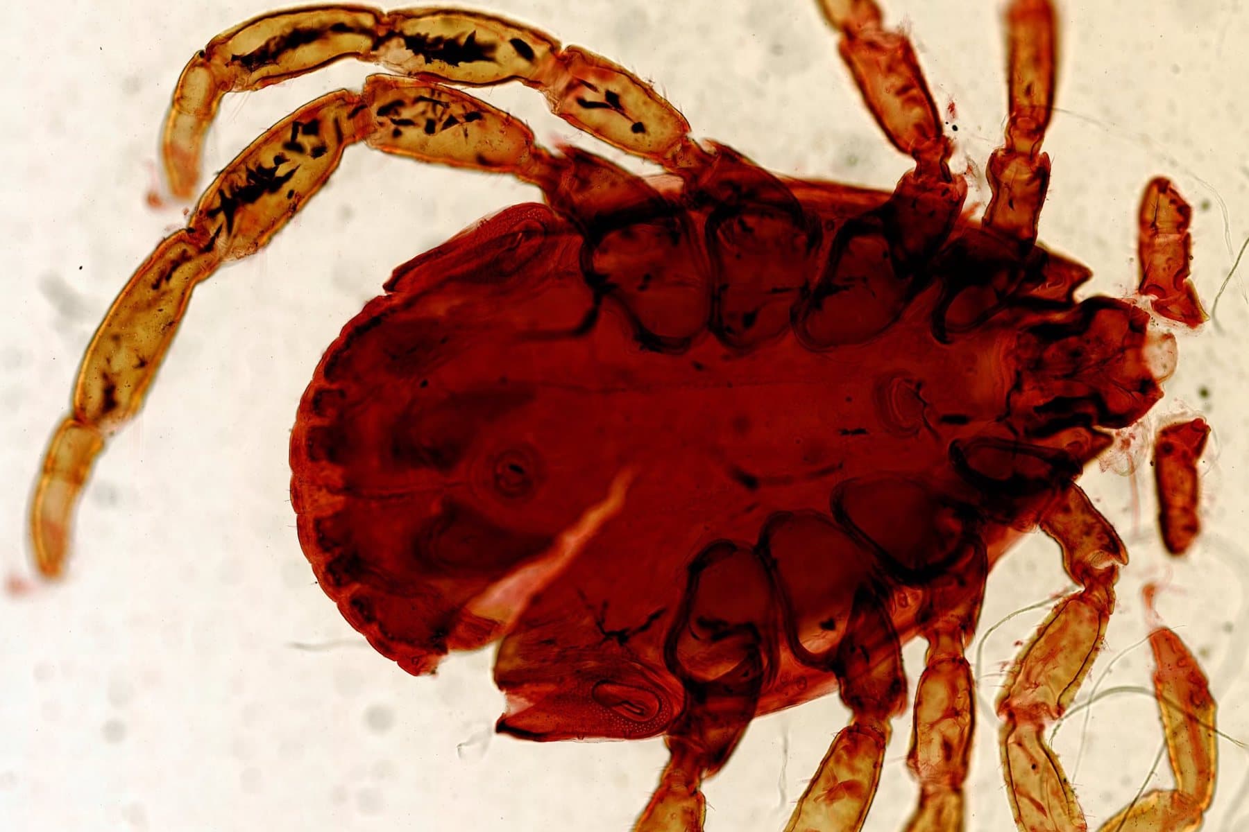 Tick Whole Slide Image Viewer-uScopeMXII 20x (0.40NA) :: Microscopes Intl.