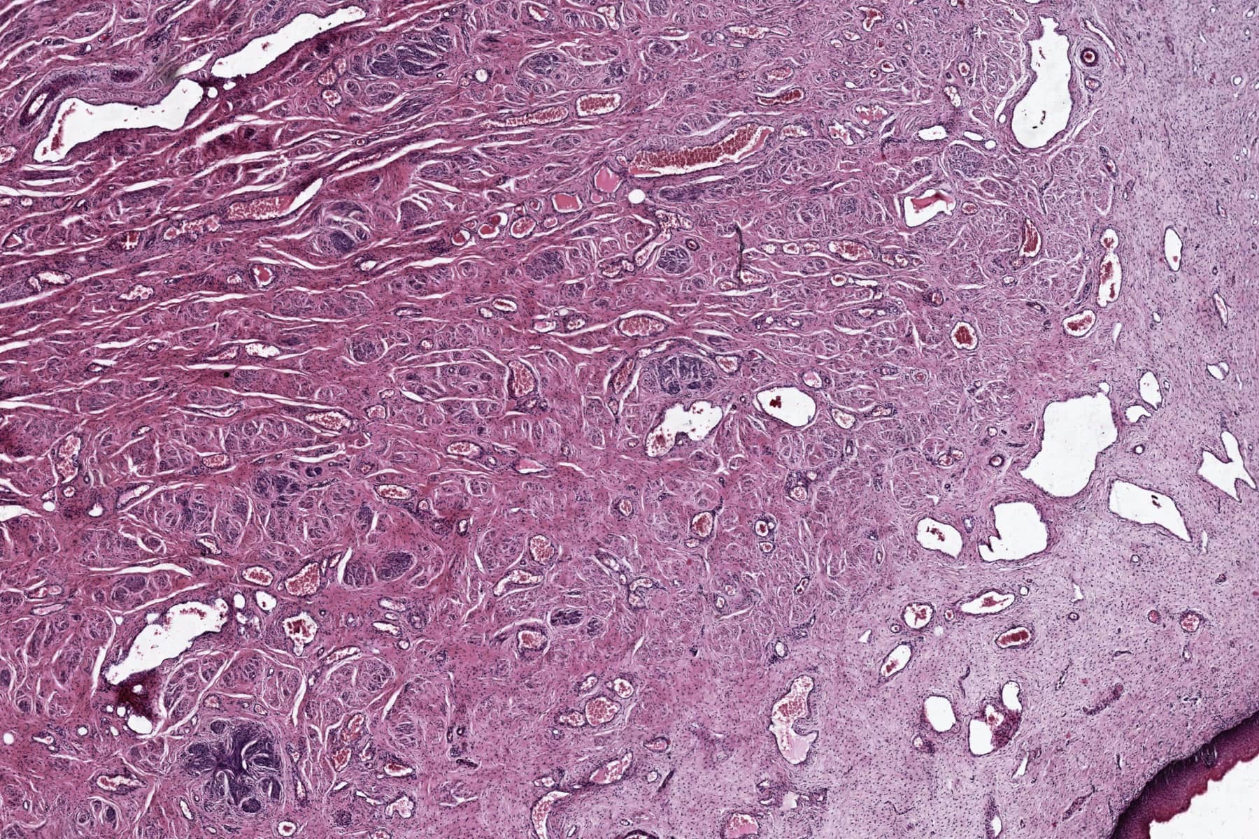 Chronic Cervicitis Whole Slide Image Viewer-uScopeMXII 40x (0.65NA ...