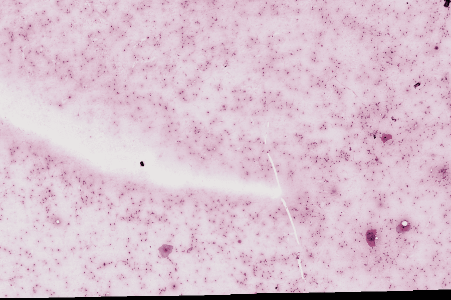 Human Sperm Whole Slide Image Viewer-uScopeMXII 60x (0.85NA ...